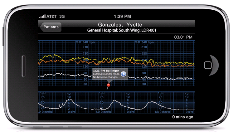 Healthcare Technology and News: Born Smart: AirStrip OB Delivers Mother ...